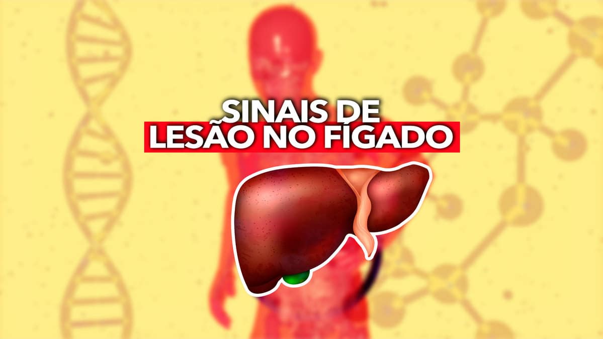 ESTES sinais podem indicar lesão no fígado; seu corpo apresenta algum ...